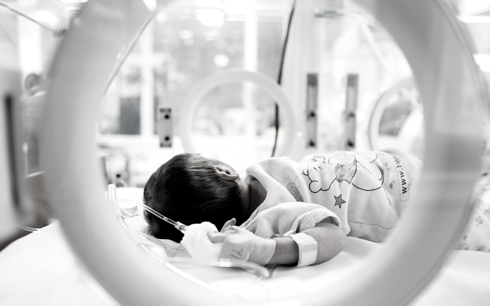 Signs Of Brain Damage In Babies & Malpractice