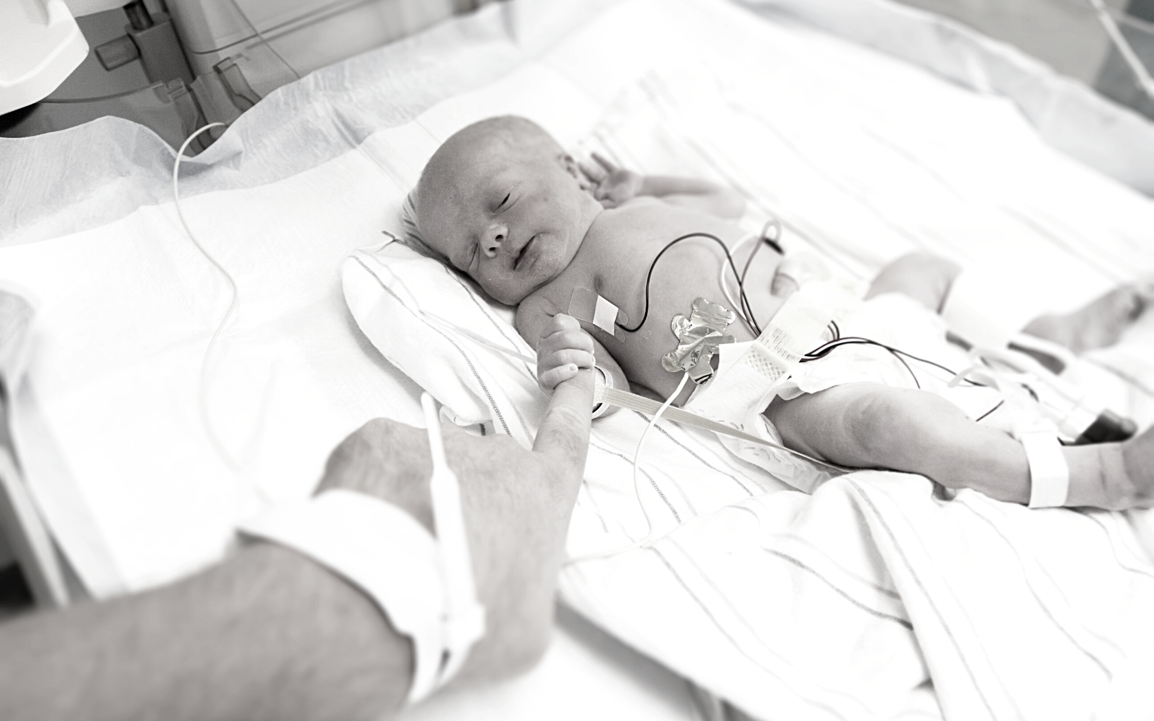 Is Your Baby A Victim Of A Newborn Brain Bleed?