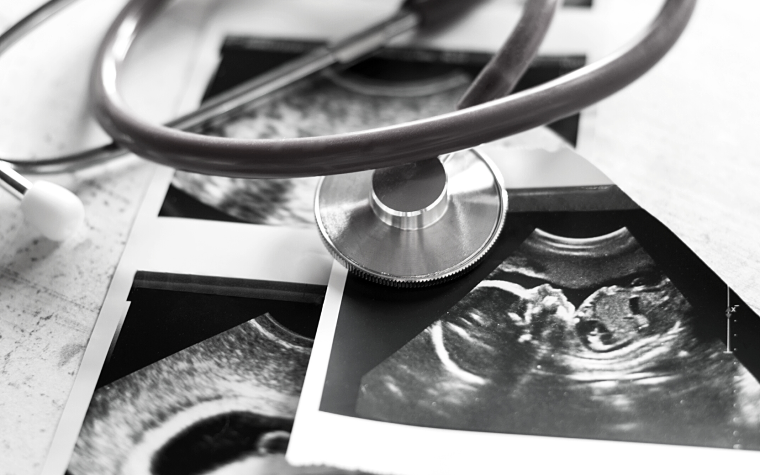 Betamethasone For Preterm Labor