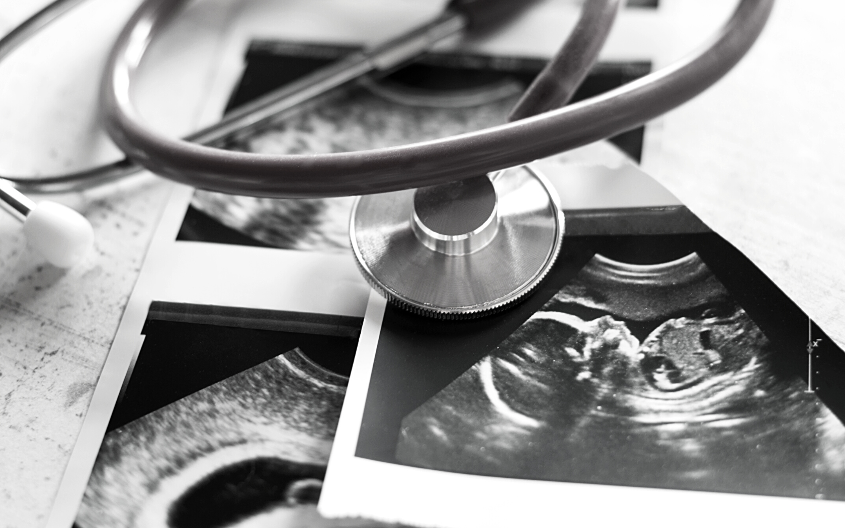 Betamethasone For Preterm Labor