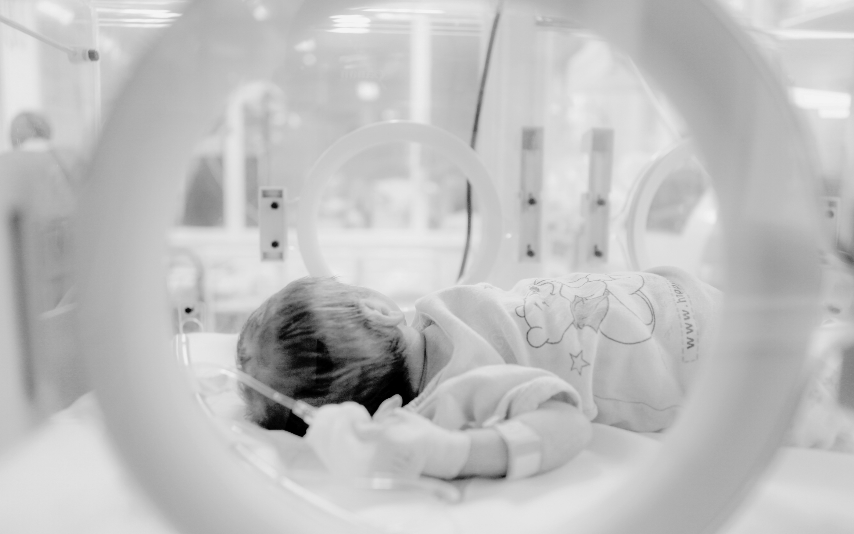 Is Face Presentation Birth Dangerous? Complications & Legal Help