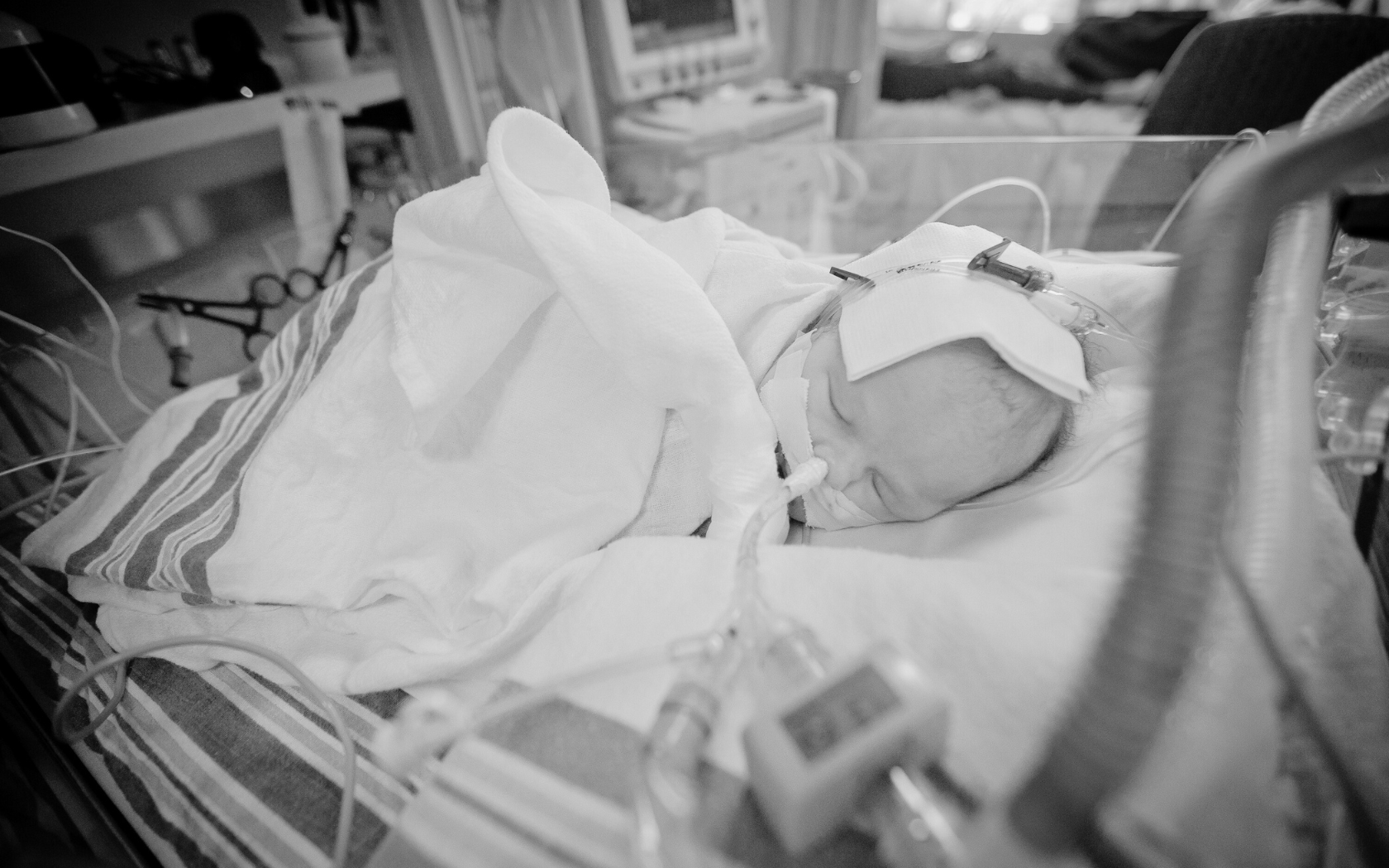 What are the Signs of a Brain Bleed in Babies?